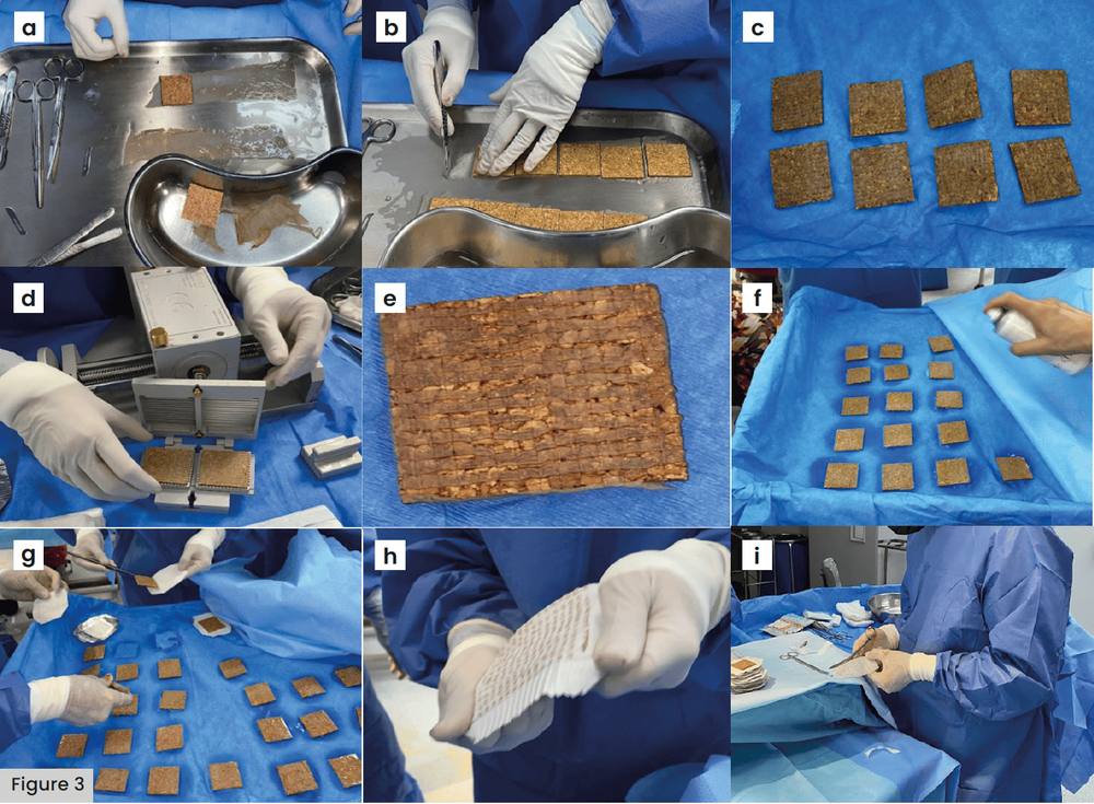 The Meek micrografting technique: clinical applications and outcomes in ...